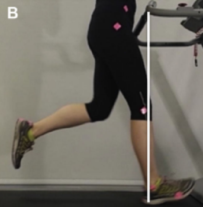 How to prevent running injuries PART 1 | Australian Institute of Fitness