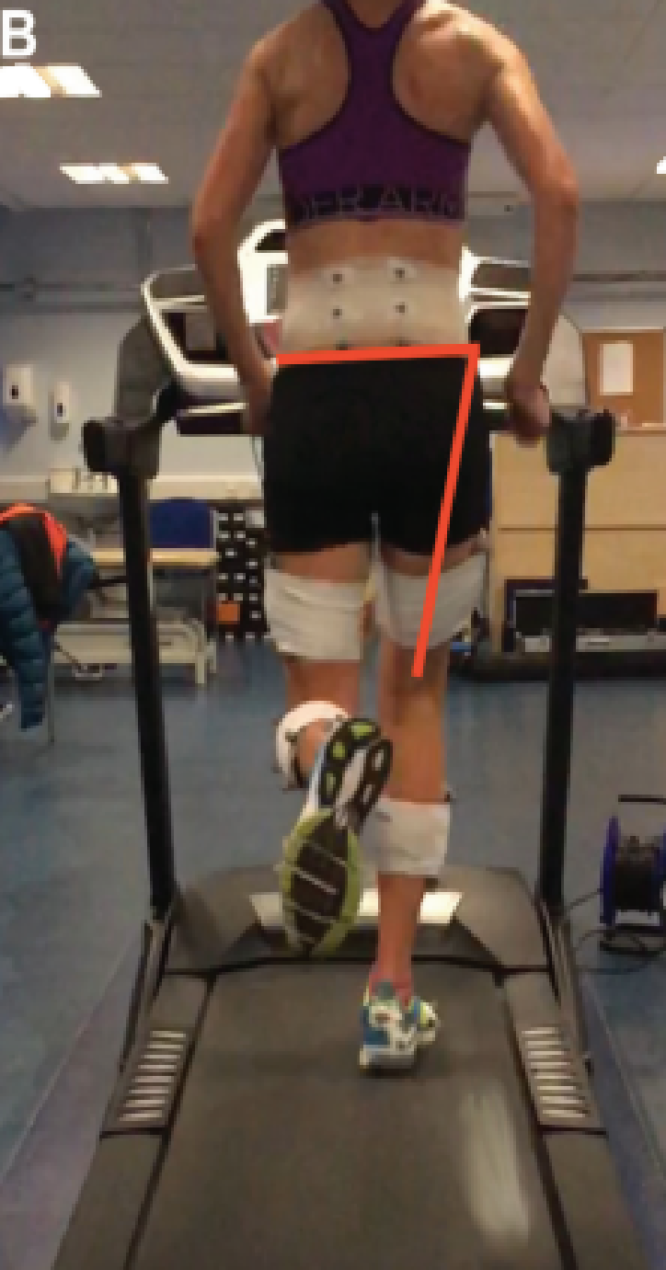 How to prevent running injuries PART 1 | Australian Institute of Fitness